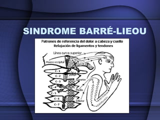 Artrosis cervical dr. sandy cadena | PPT