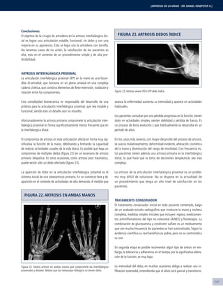 Artrosis de la mano | PDF