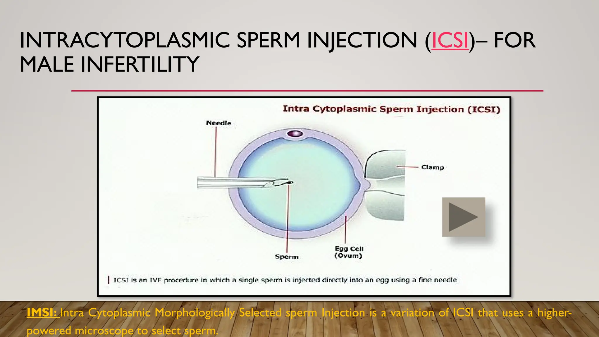 ART technuques iui ivf icsi picsi sperm collection | PPT