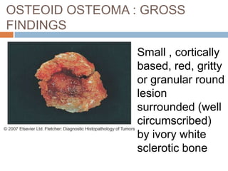 osteogenic bone tumors & fibrous dysplasia | PPTX