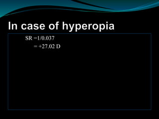 spectacle refraction versus ocular refraction | PPTX