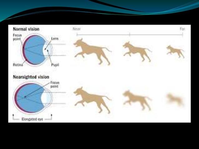 spectacle refraction versus ocular refraction | PPTX | Eye and Vision ...
