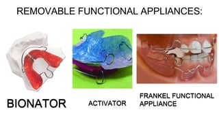 MYOFUNCTIONAL APPLIENCES.DR ARUNESH VERMA KGMU pptx | PPT