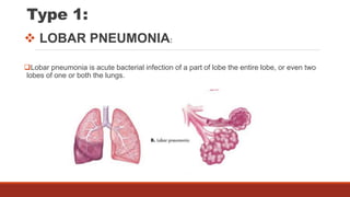 PNEUMONIA PATHOPHYSIOLOGY.pptx