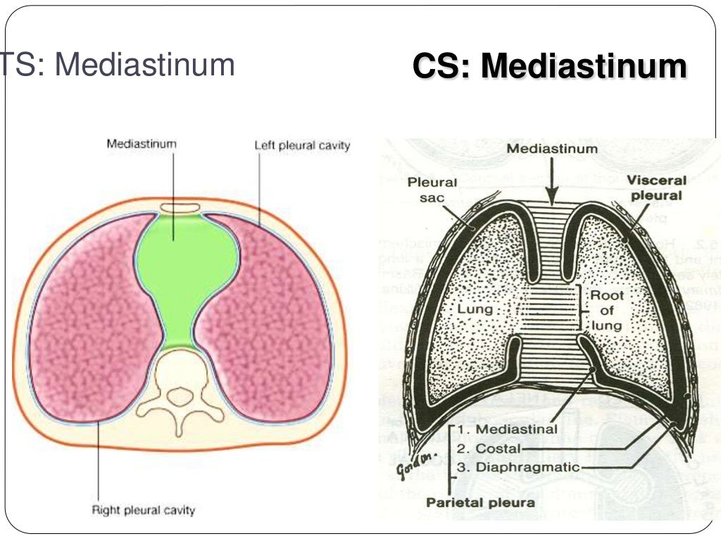mediastinal imaging and masses