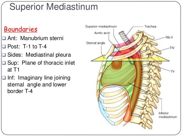mediastinal imaging and masses