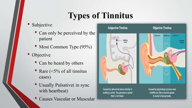 Middle Ear Myoclonus(MEM) | PPTX | Ear, Nose and Throat Conditions ...