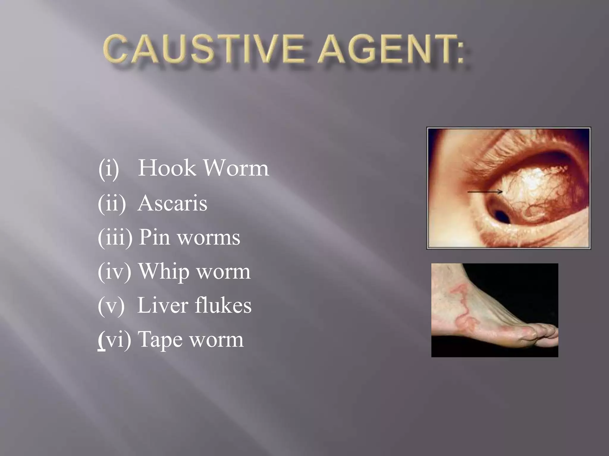 Worm infestation | PPTX