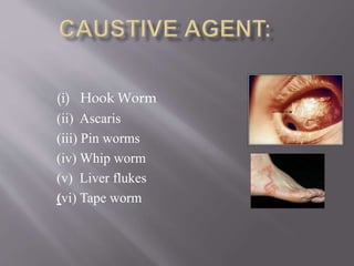 Worm infestation | PPTX