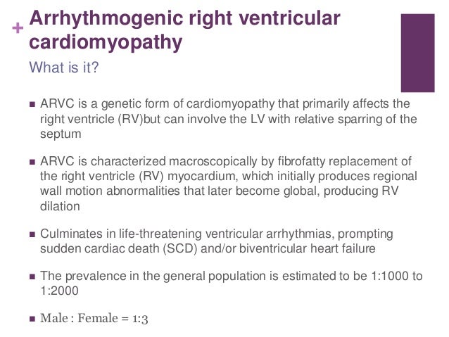 arrhythmogenic right ventricular dysplasia/Cardiomyopathy
