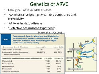 ARRHYTHMOGENIC RIGHT VENTRICULAR DYSPLASIA/CARDIOMYOPATHY | PPTX
