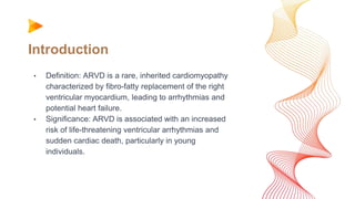 Arrhythmogenic Right Ventricular Dysrhythmias.pptx