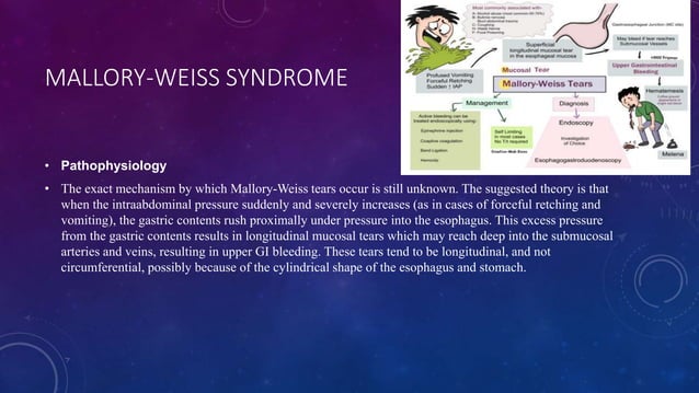 Complications of gastric ulcer and duodenal ulcer (bleeding ...