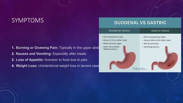 Complications of gastric ulcer and duodenal ulcer (bleeding ...