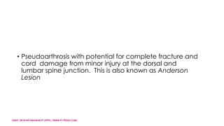 Ankylosing Spondylitis - Dr Rohit Bhaskar | PPT