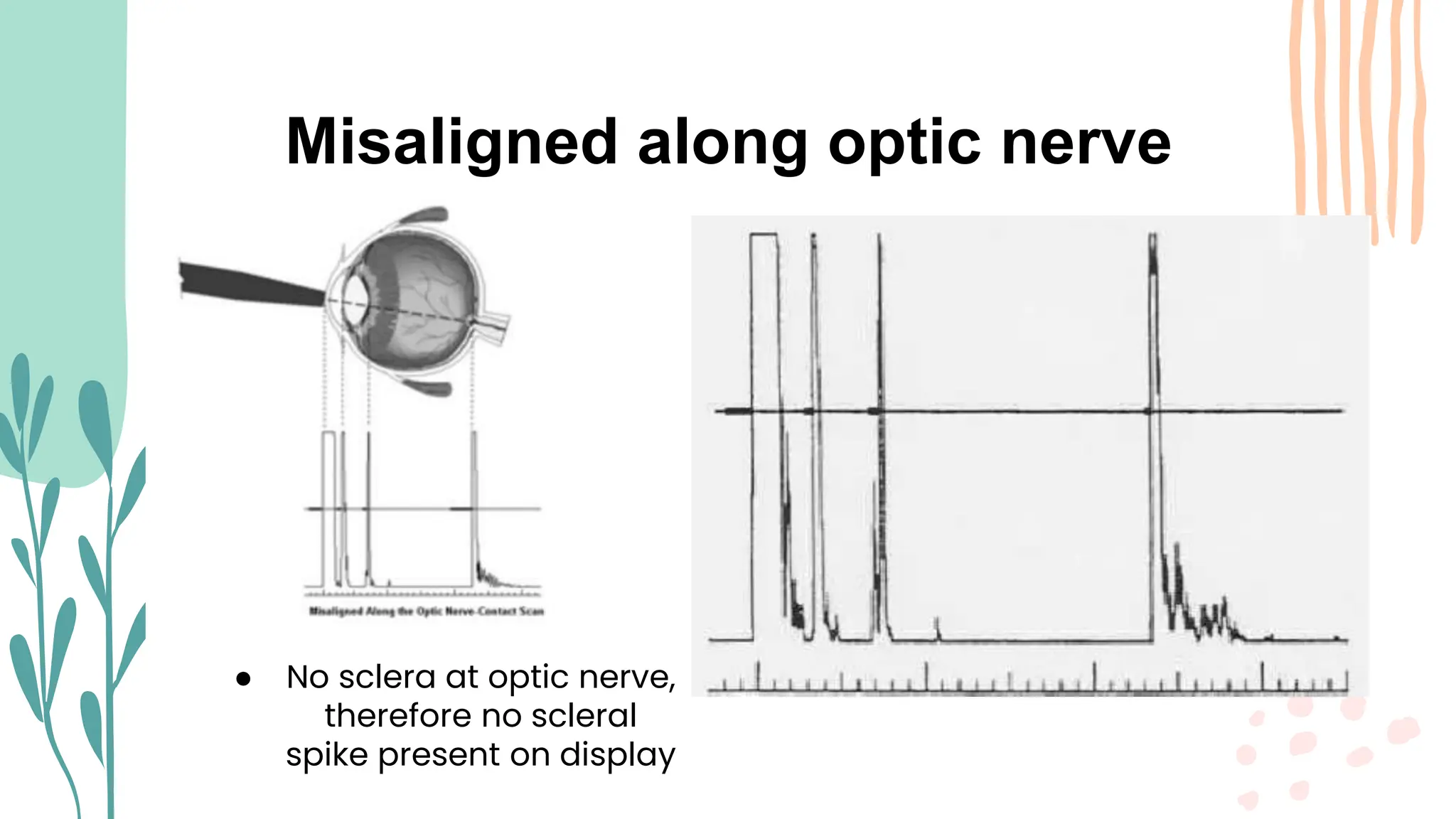 A Scan technique and principles for getting acccurate values for ...