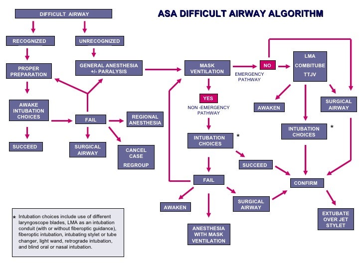 A S A D I F F I C U L T A I R W A Y A L G O R I T H M