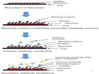 Immunoelectron Microscopy. | PPTX