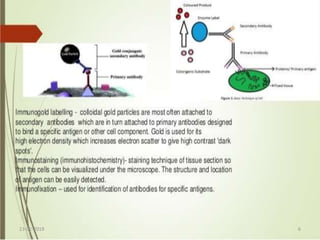 Immunoelectron Microscopy. | PPTX