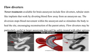 Aneurysmic Subarachnoid Haemorrhage (aSAH) | PPTX