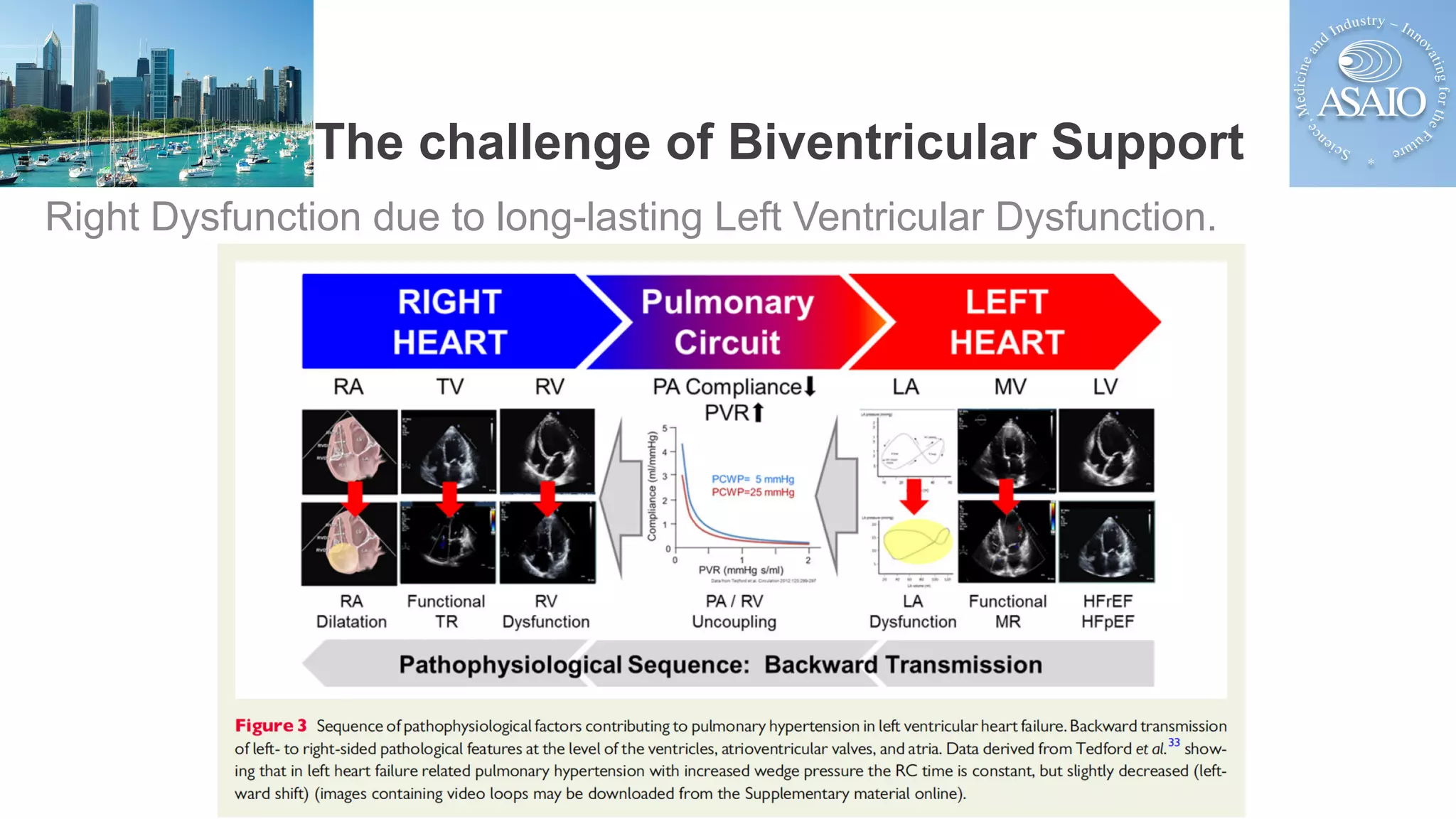 Asaio 2017: Predicting Right Ventricular Failure in CF-LVAD Era. | PPT
