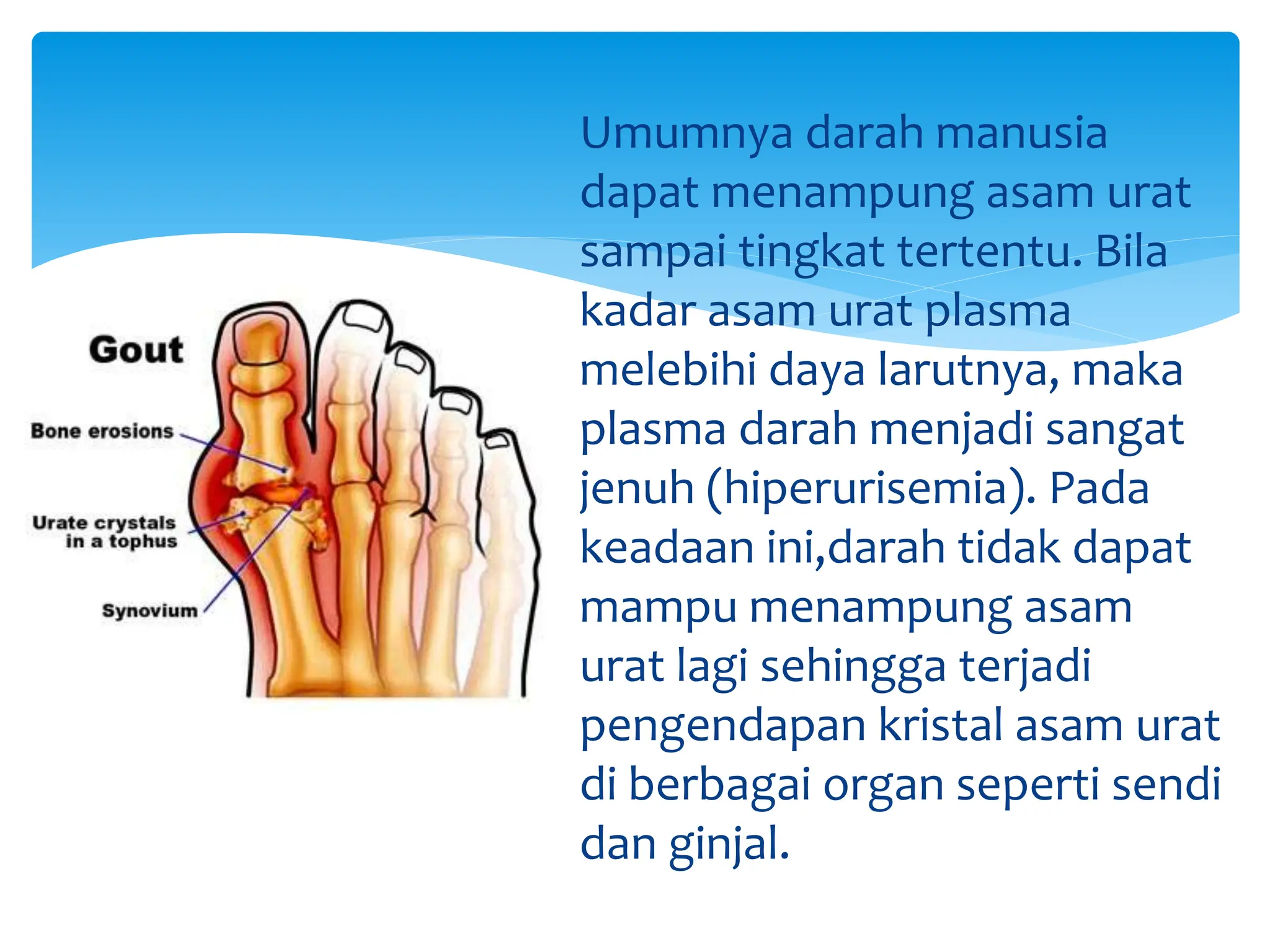 pegelolaan penyakit asam urat pada lansia.pptx