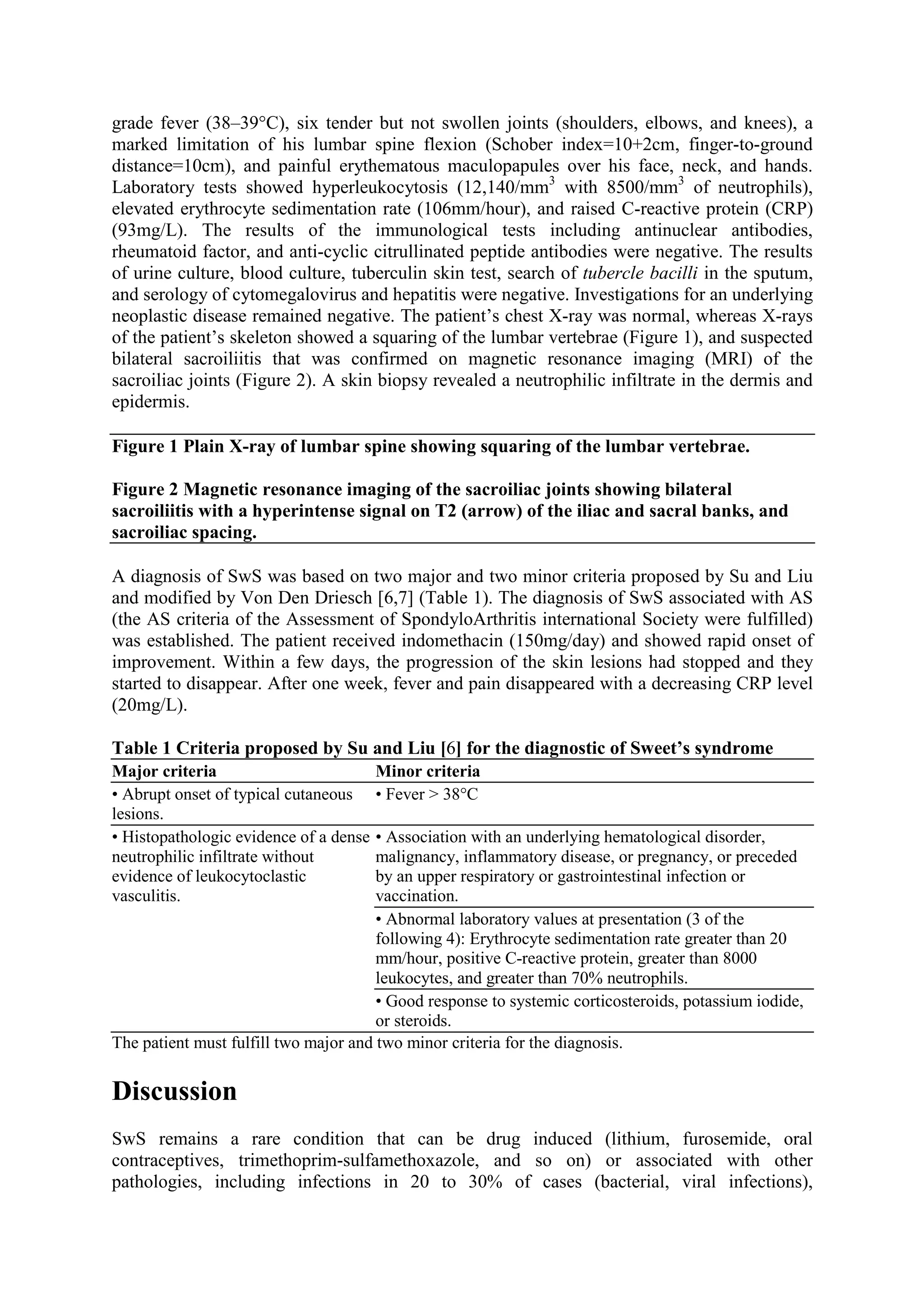 As and sweets syndrome | PDF