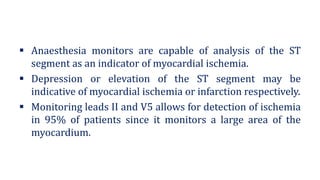 ASA recommended monitoring | PPT