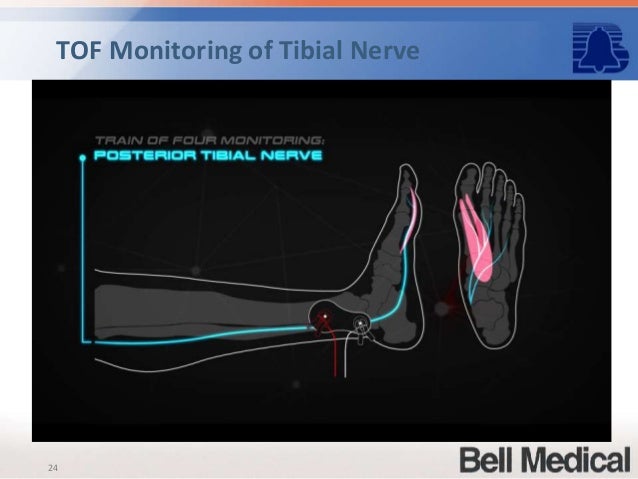Neuromuscular Blocking Agent Monitoring with Stimpod NMS 450 Quantita…