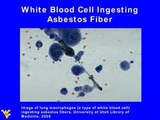 Asbestos in Buildings and Health Effects | PPT