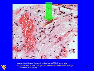 Asbestos in Buildings and Health Effects | PPT