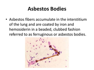 Asbestos Bodies