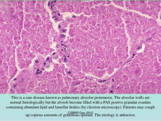Asbestos&Berylliosis