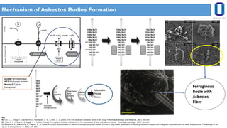 Asbestos bodies formation studies in human lung | PPT