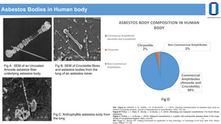 Asbestos bodies formation studies in human lung | PPT