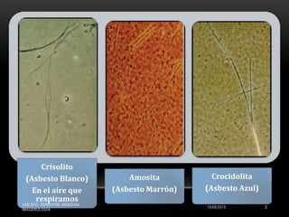 Asbestosis | PPTX