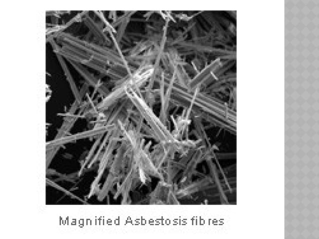 ASBESTOSIS presentation in detail.............. | PPTX