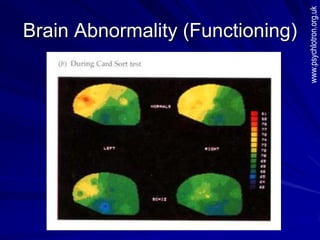 AS The biological model of abnormality | PPTX