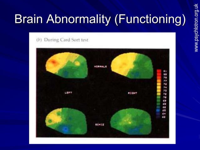 AS The biological model of abnormality | PPT
