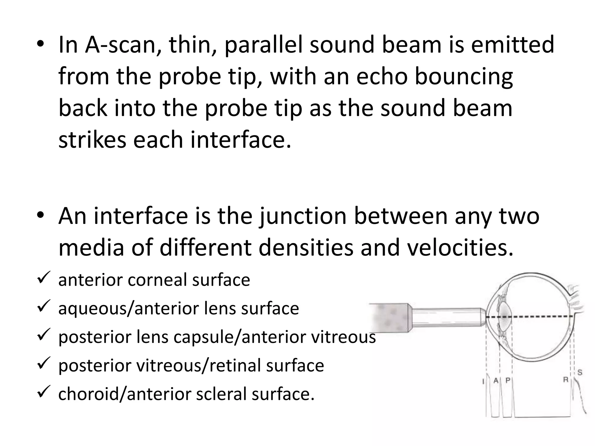 A SCAN, B SCAN & BIOMETRY---19.pptx