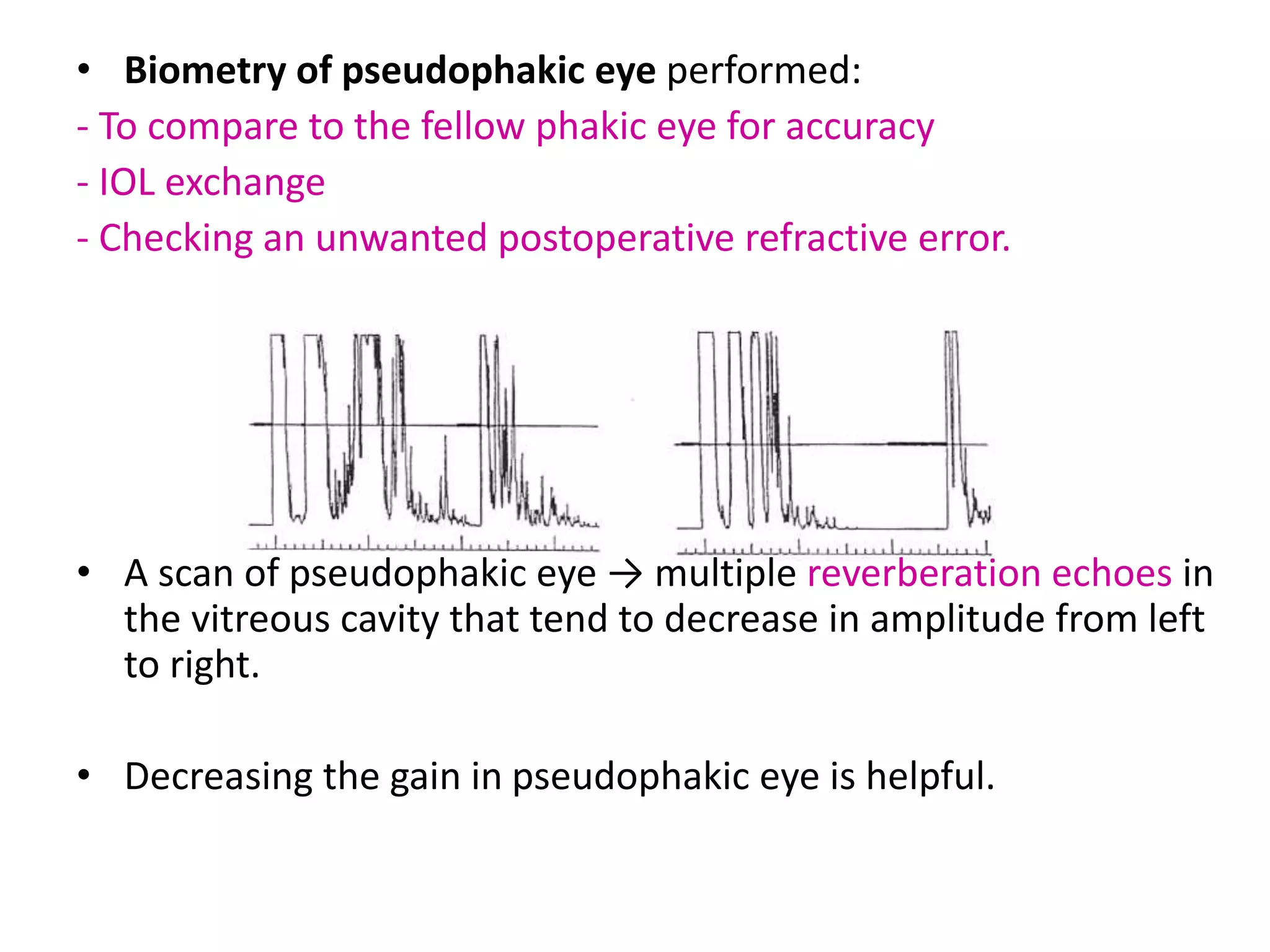 A SCAN, B SCAN & BIOMETRY---19.pptx