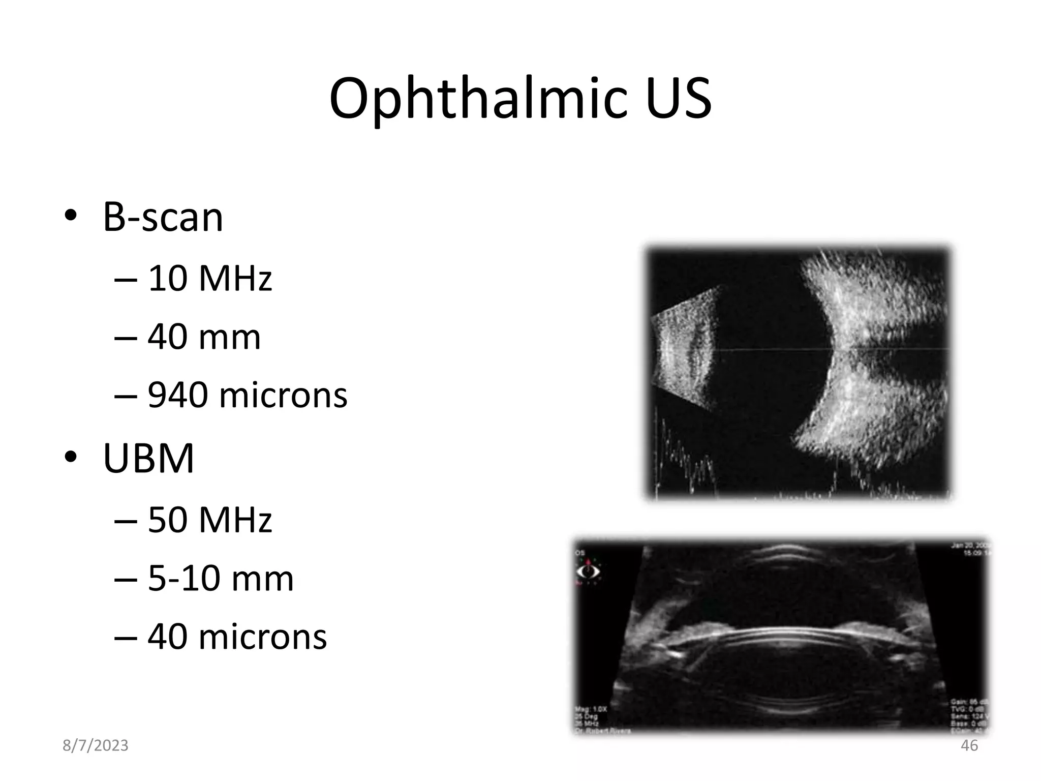 A SCAN, B SCAN & BIOMETRY---19.pptx