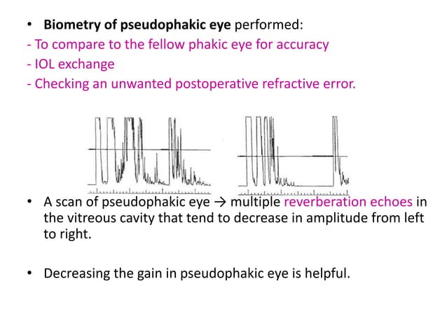 A SCAN, B SCAN & BIOMETRY---19.pptx | Eye and Vision Conditions ...