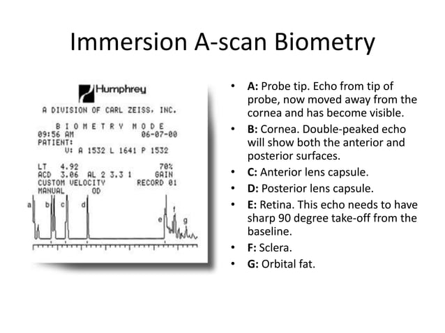 A SCAN, B SCAN & BIOMETRY---19.pptx | Eye and Vision Conditions ...