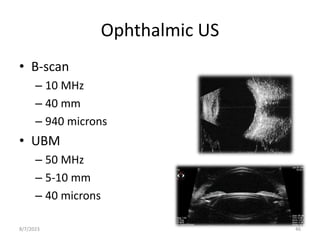 A SCAN, B SCAN & BIOMETRY---19.pptx