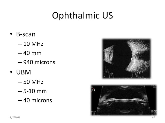 A SCAN, B SCAN & BIOMETRY---19.pptx | Eye and Vision Conditions ...