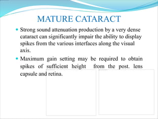 A-scan in special cases | PPTX