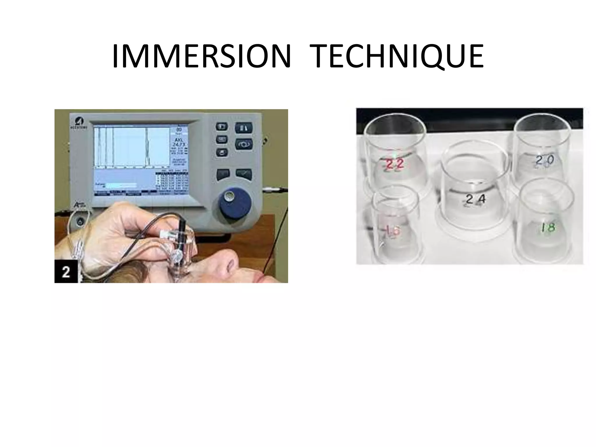 A scan ultrasonography | PPTX