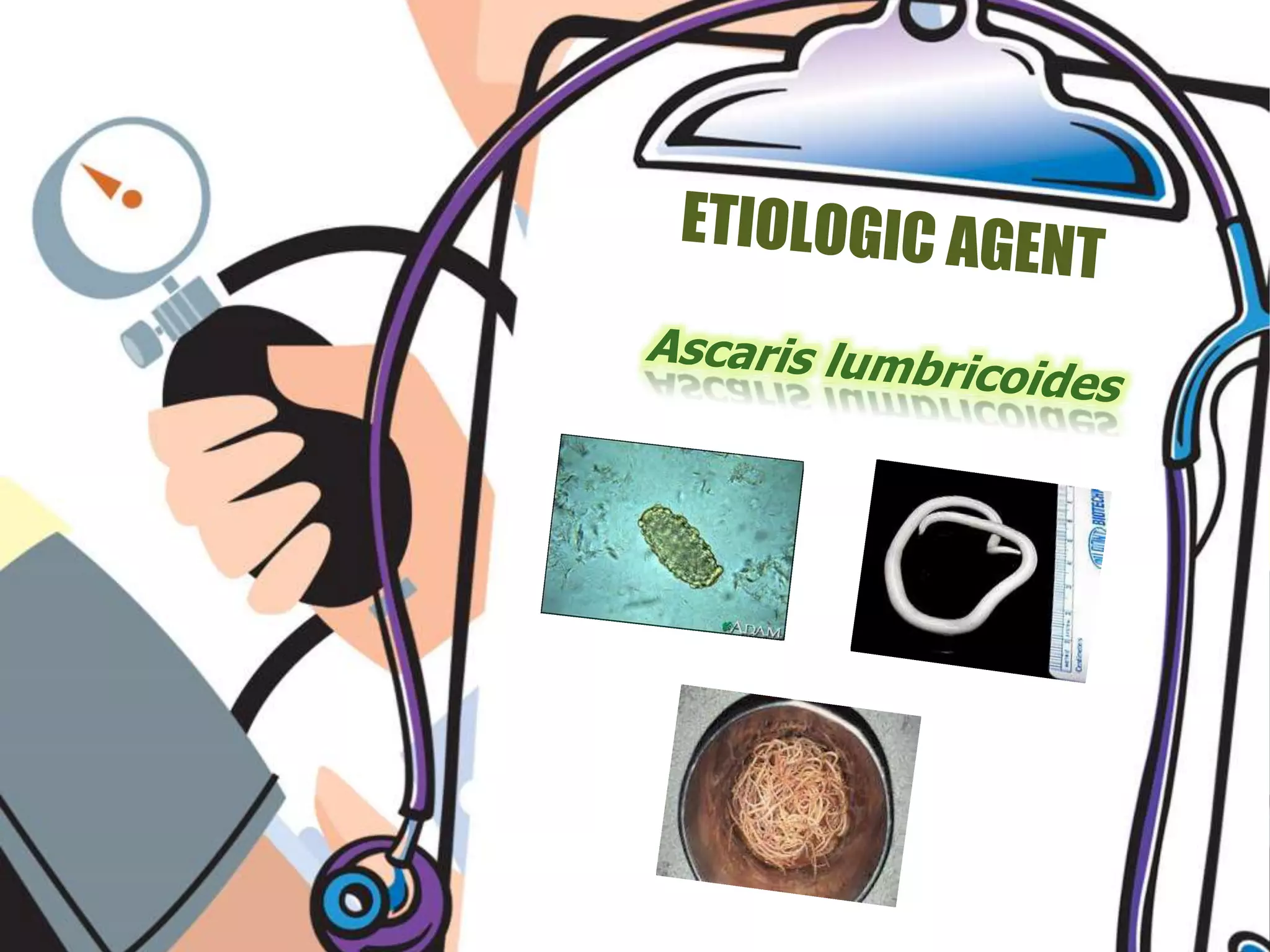 Ascariasis Case Presentation | PPTX