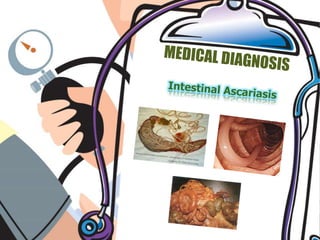 Ascariasis Case Presentation | PPTX